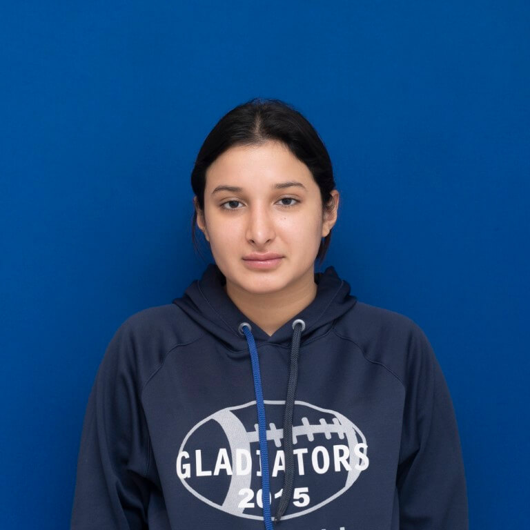 Rhinoplasty Patient 3 – Shah Plastic Surgery